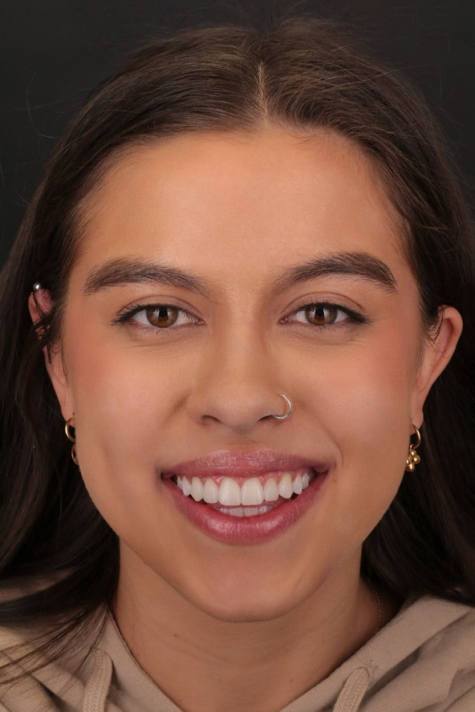 Dental Smile Gallery - LUME Dental in Wilmslow